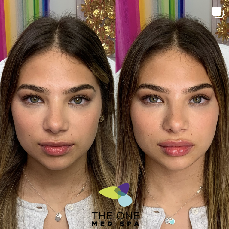 Testimonials – The One Med Spa